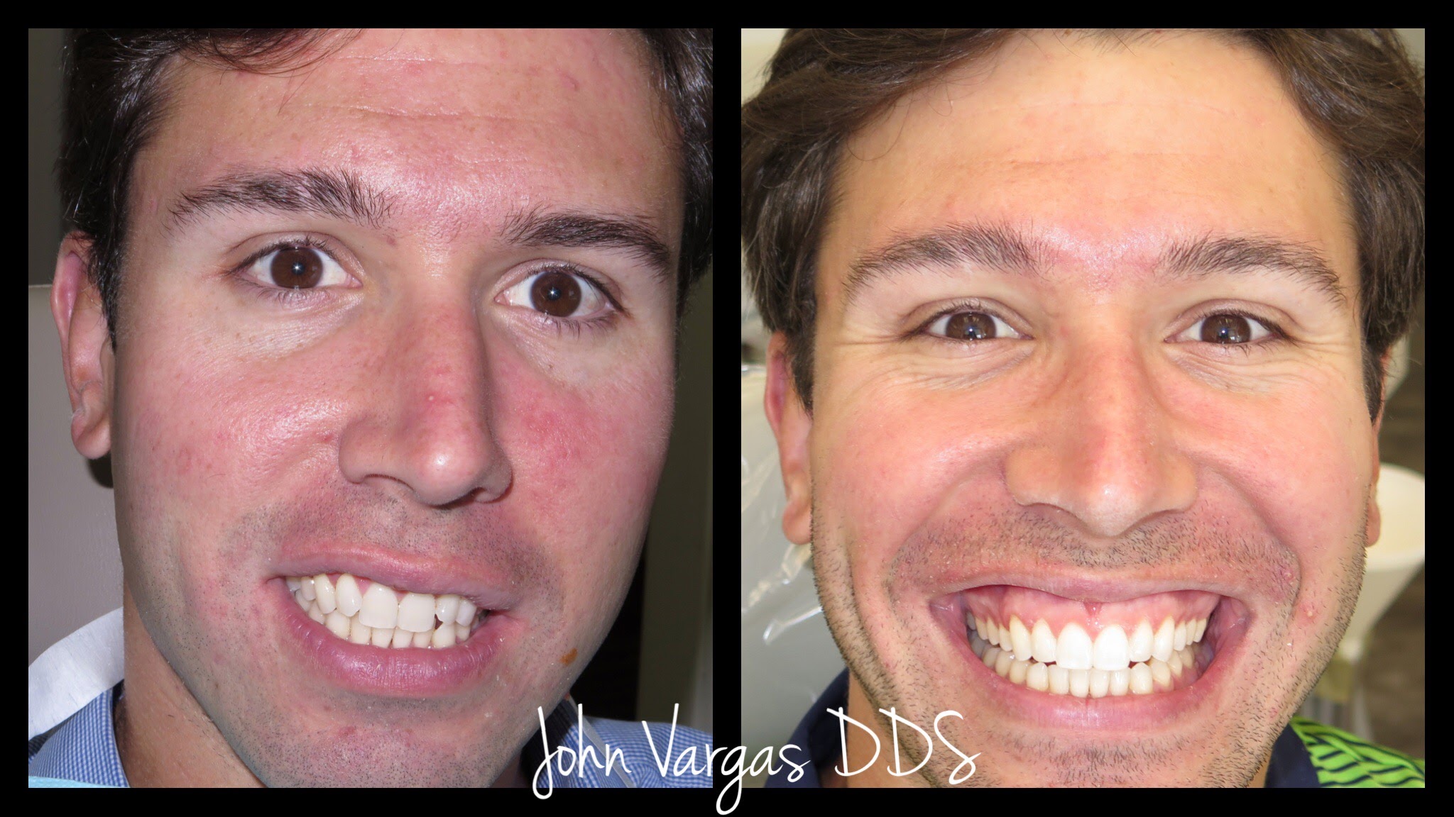 Thank You Dream Smile Preview - Invisalign - Chappaqua Smiles